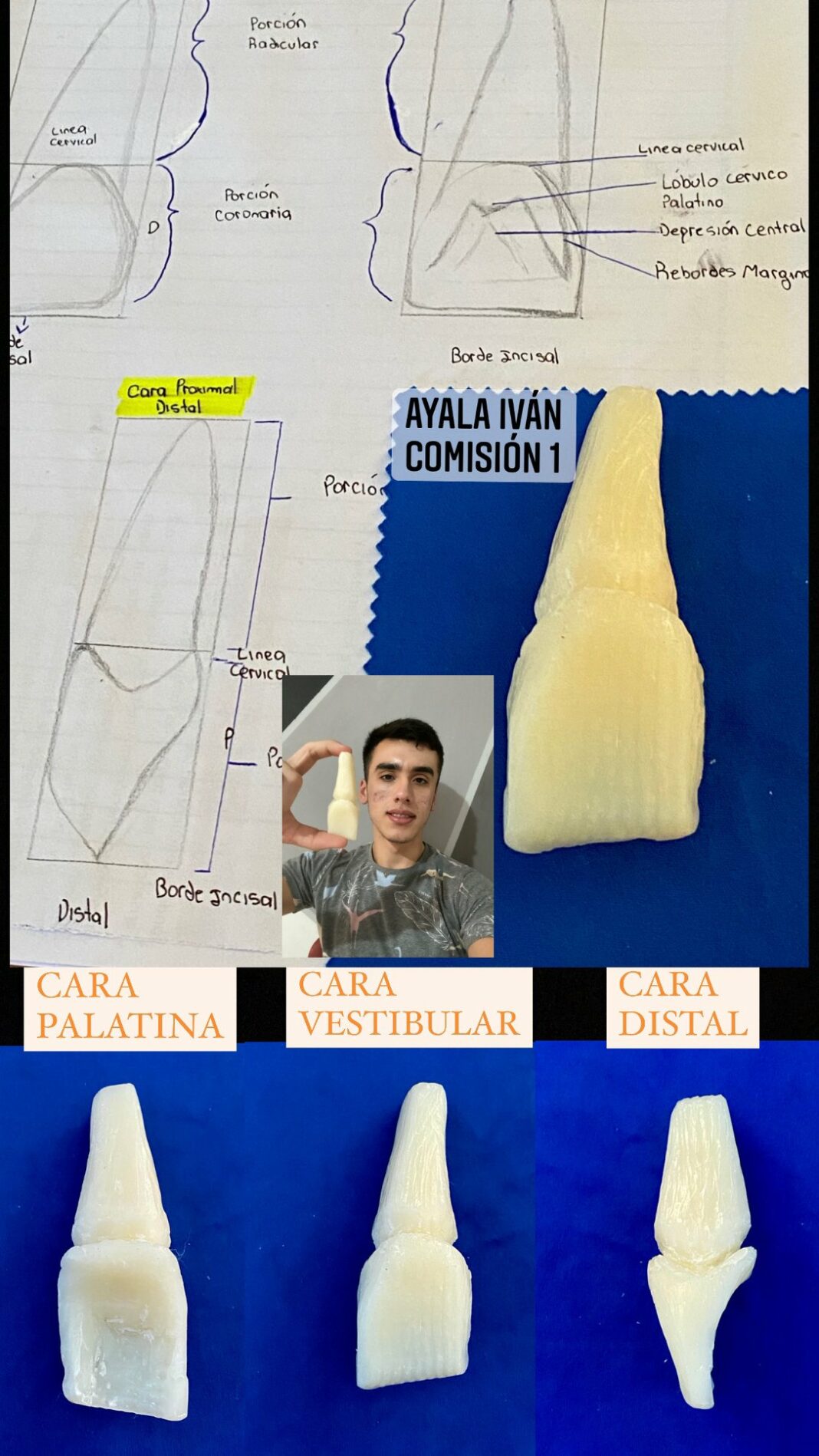 Tallado de dientes en jabón, una estrategia surgida en pandemia que ...