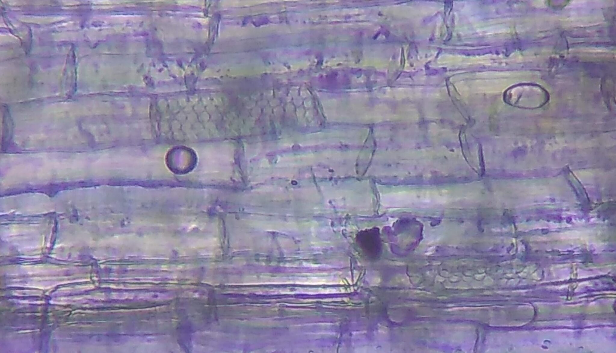 Estudian al vector de un virus de alto riesgo para la producción de ...