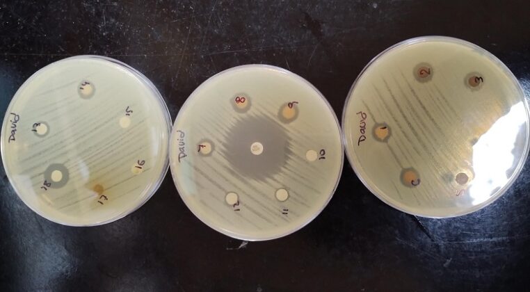 Nanopartículas de plata: una solución innovadora contra las infecciones ...